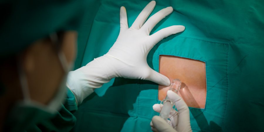 Suntik Epidural: Untuk Prosedur Operasi Caesar dan Pereda Nyeri - Yoona