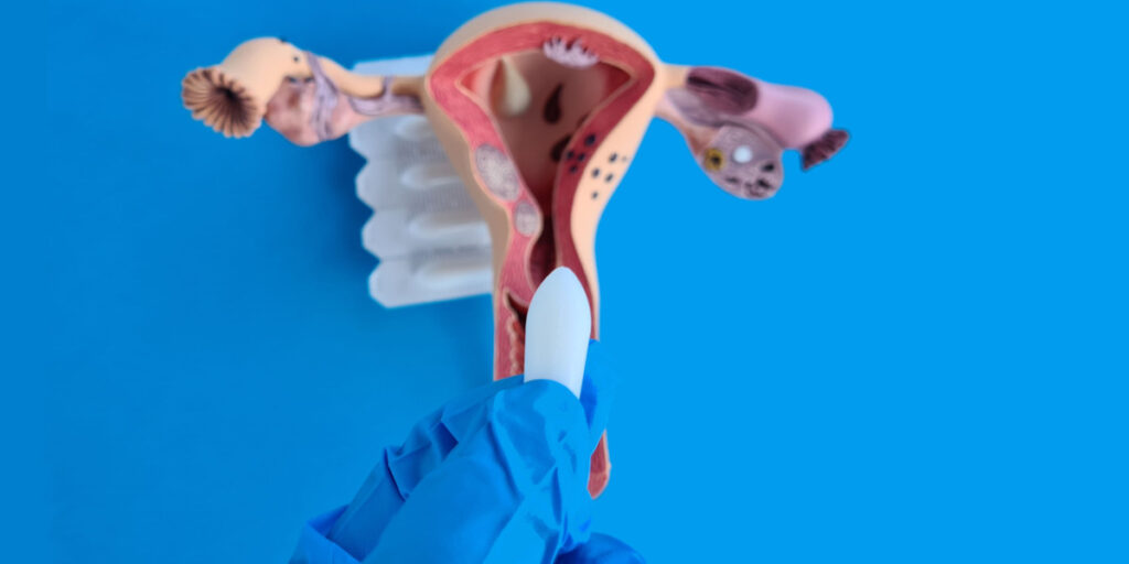 Apa Itu Selaput Dara dan Dimana Letaknya? Ini Fakta Menariknya! - Yoona