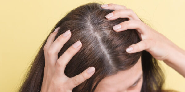 8 Cara Menghilangkan Uban di Usia Muda Secara Alami - Yoona