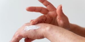 Kloderma Salep: Dosis, Manfaat, dan Efek Samping Obat - Yoona