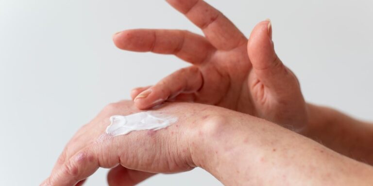 Manfaat, Dosis, Penggunaan dan Efek Samping Obat Apisate - Yoona