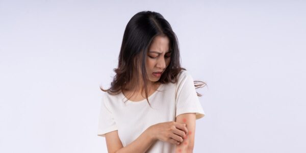 Ciri-Ciri HIV pada Kulit yang Perlu Diwaspadai - Yoona